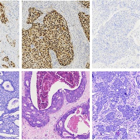 the samples of ihc and he stained images download scientific diagram