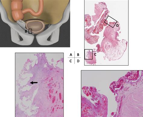 Histopathological Findings A The Positional Relationship Between The Download Scientific