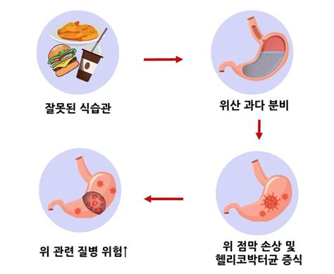 소화 돕는 위산 과다분비는 위장병 원인 세계일보