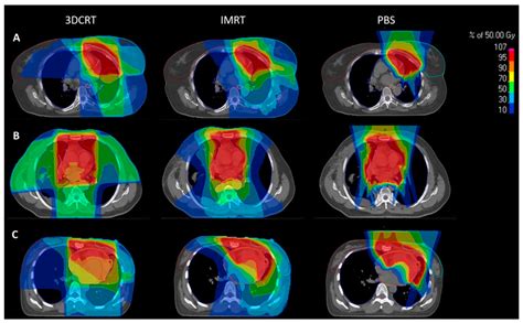 Three Representative Patients Ac With Their Comparative 3dcrt First