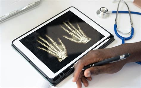 How Machine Learning And AI Are Transforming Healthcare Diagnostics In