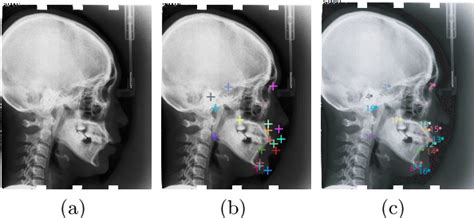 Figure 1 From Automatic Globally Optimal Pictorial Structures With