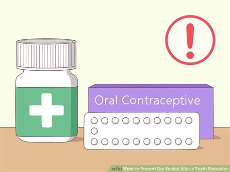 4 Ways To Prevent Dry Socket After A Tooth Extraction Wikihow