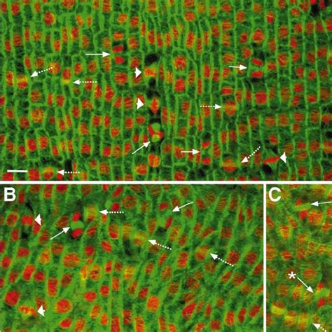 Mts And Dna In Epidermal Cells Of Maize Leaf Primordia Download