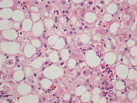 Programme London Gi Pathology Update