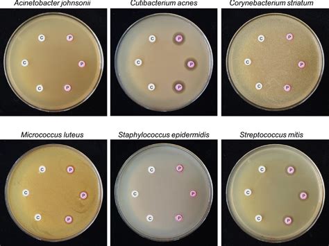 Paper Disc Assay Of The Antibacterial Activity Of Prodigiosin Against