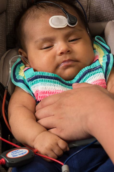 Cmv A Leading Cause Of Newborn Hearing Loss That Youve Never Heard Of University Of Utah Health