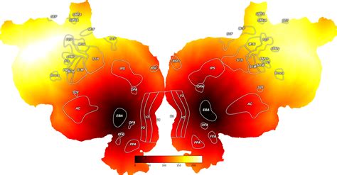 Plotting Geodesic Distances — Pycortex 130dev0 Documentation