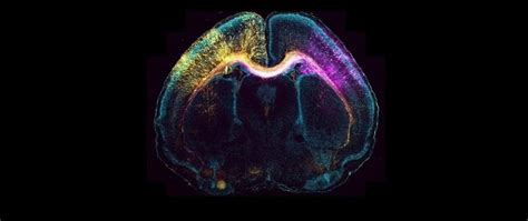 The Neuronal Centrosome Controls Radial Migration Of Projection Neurons