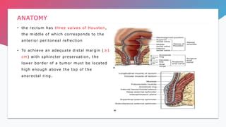 Rectal Carcinomapptx