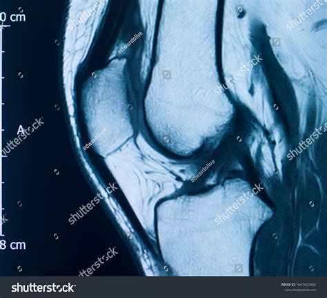 246 Knee Ligament Testing 图片、库存照片和矢量图 Shutterstock