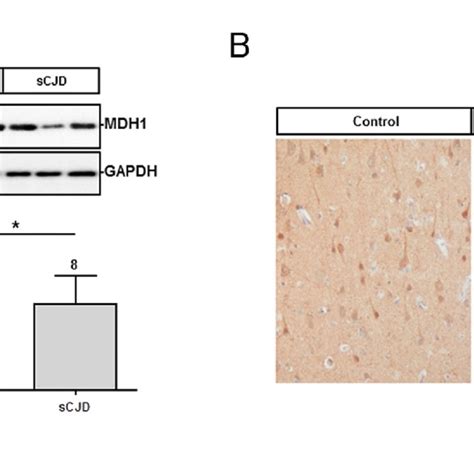 Determination Of Expression Level And Localization Of Mdh1 In Brain Download Scientific Diagram