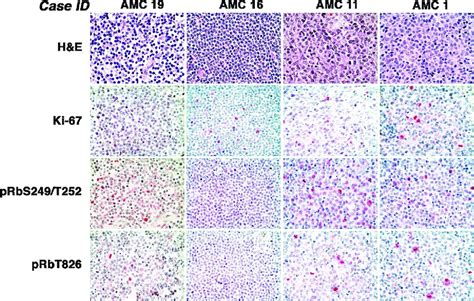 Proliferation And Rb Phosphorylation In Representative Samples Of