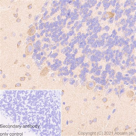 recombinant anti dctn1 p150 glued antibody [12 p150glued] ab302964