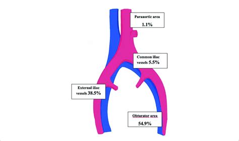 Anatomic Distribution Of Sentinel Lymph Nodes Download Scientific Diagram