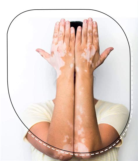 Excimer Dr Sajjas Clinic In Tirupati