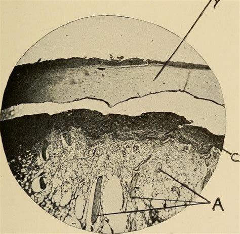 Microstructure Of Bone Flashcards Quizlet