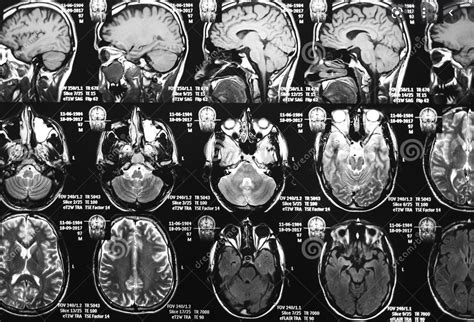 一文看懂 计算机视觉 Cv 与 计算机图形学 Cg 的区别什么是计算机视觉 Computer Vision ？与计 掘金