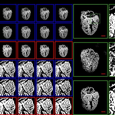 Comparison Of Segmentation Results A Non Overlapping And B