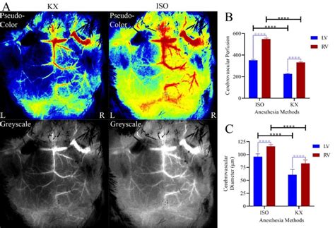 Comparison And Quantitative Analysis Of Cerebrovascular Perfusion And