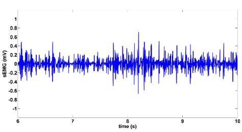 Cleaned Semg After Ecg Interference Removal Download Scientific Diagram