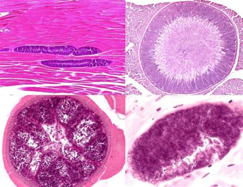 Lab 1 Sporozoa Apicomplexa Of Protozoa Flashcards Quizlet