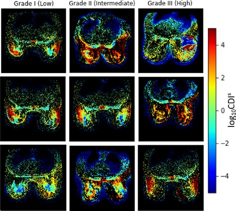 Figure 1 From A Multi Institutional Open Source Benchmark Dataset For Breast Cancer Clinical