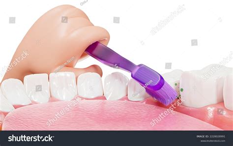 Brushing Technique Modified Bass