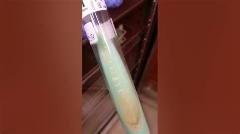 Mycobacterium Tuberculosis Tb On Lj Agar Microbiology Youtube