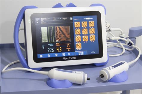 Non Invasive Determination Of Liver Fibrosis And Steatosis Fibroscan