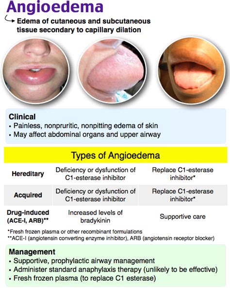 Angioedema Nursing Schools Near Me Online Nursing Schools Nursing School Notes Lpn Schools