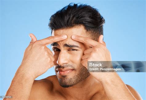 스킨케어 혼란스럽고 불안 의심 스트레스로 여드름을 느끼는 얼굴에 손을 얹은 여드름 남자의 초상화 파란색 배경에 얼굴 미적 문제가 있는 피부를 분석하는 스튜디오의 모델