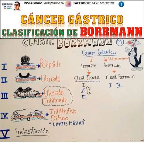 ClasificaciÓn De Borrmann Esta Clasificación Se Usa Para El Cáncer