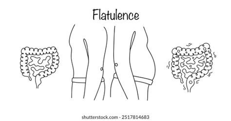 People With Flatulence Hơn 456 Hình Minh Họa Và Hình Vẽ Có Sẵn Miễn Phí Bản Quyền Có Thể Cấp