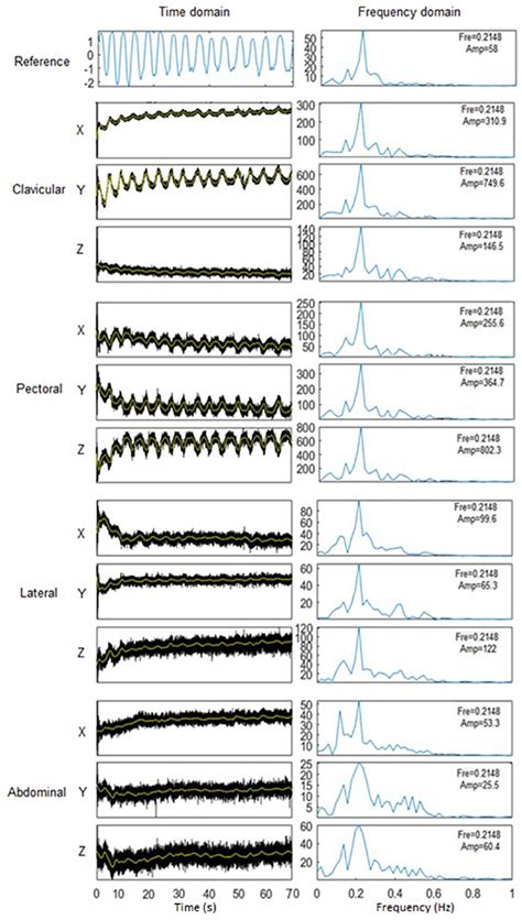 Respiratory Rate And Flow Waveform Estimation From Tri Axial Accelerometer Data At Margaret