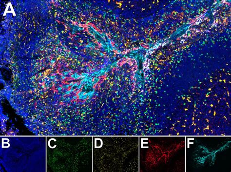 Secrets To Efficient Multiplex Ihc Analysis Revealed
