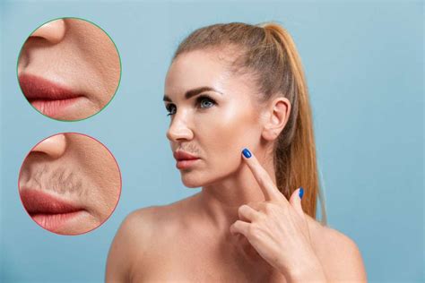 Upper Lip Laser Hair Removal Your Key To A Smoother Face