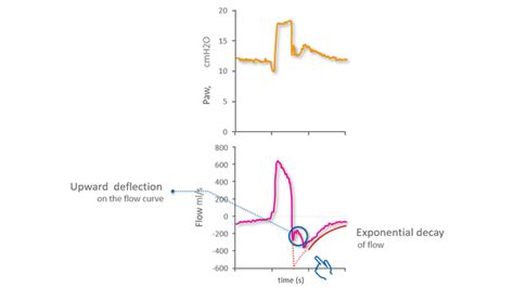 Using Waveforms To Identify Asynchronies Step 2 Hamilton Medical
