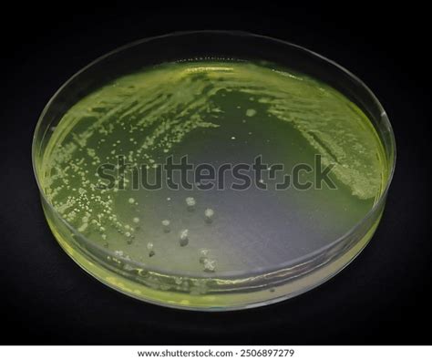 Microbiology Trichoderma Bacillus Subtilis Phytopathology Petri Stock