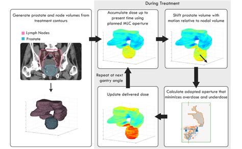 best in physics dose optimized mlc tracking and radio immunotherapy