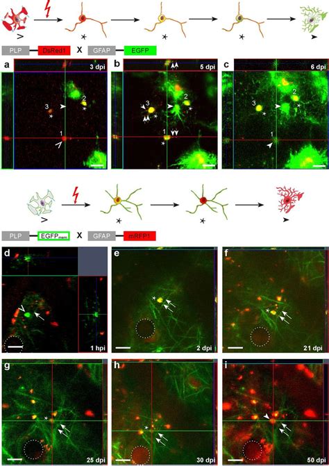 Oligodendrocytes Astrocytes