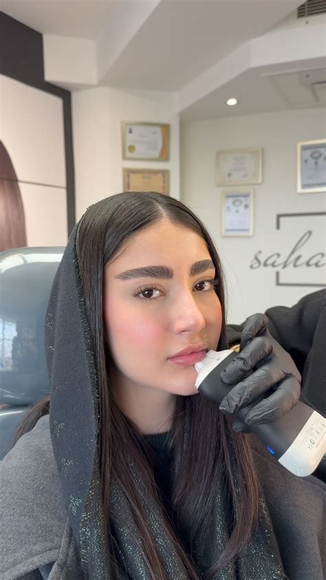 ‎دکتر سارا حاجی نجفی‎ ‎برجسته گی پشت لب از مواردی می باشد که بصورت