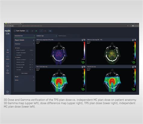 Iba Dosimetry Myqa Ion Patient Qa