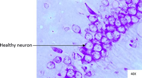 histopathology of hippocampal ca1 region of group 1—control download