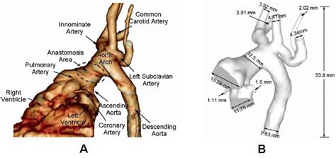 3 Reconstruction Of Three Dimensional Patient Specific Geometry A