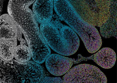 Xenium Analyzer 10x Genomics