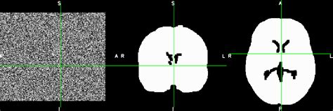 An Overview Of Neuroimaging File Formats From The Users Perspective Brainandcode