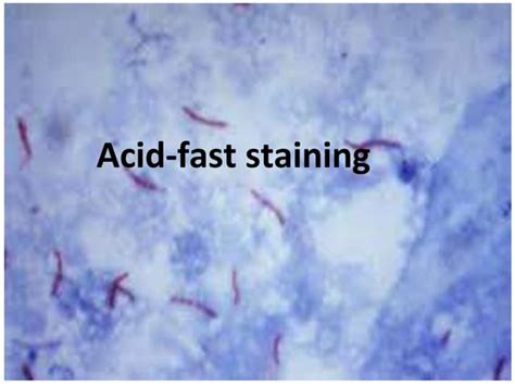 Acid Faststaining For Differentiate Acid Fast Bacteriapptx
