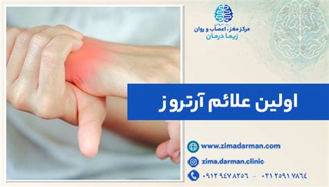 اولین علائم آرتروز نشانه‌های اولیه برای انواع آرتروز