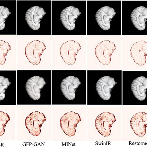 Visual Comparison Of Different Sr Reconstruction Methods On The Ixi Download Scientific Diagram